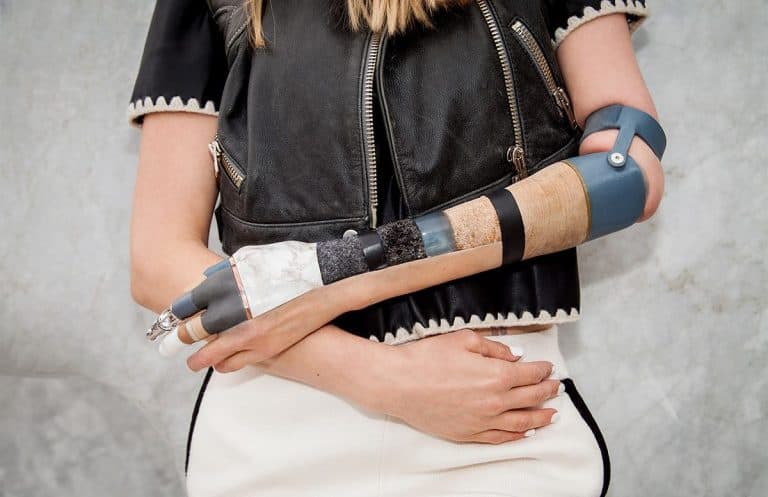 The Alternative Limb Project: The Importance Of Agency In Aesthetic ...